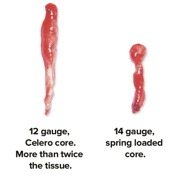 Celero | Breast Biopsy System | Hologic