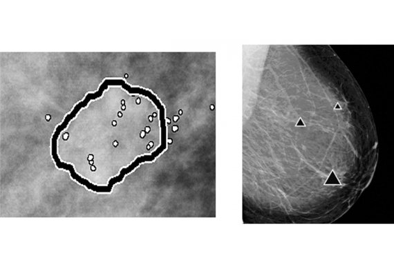 Breast Image Analytics | Hologic