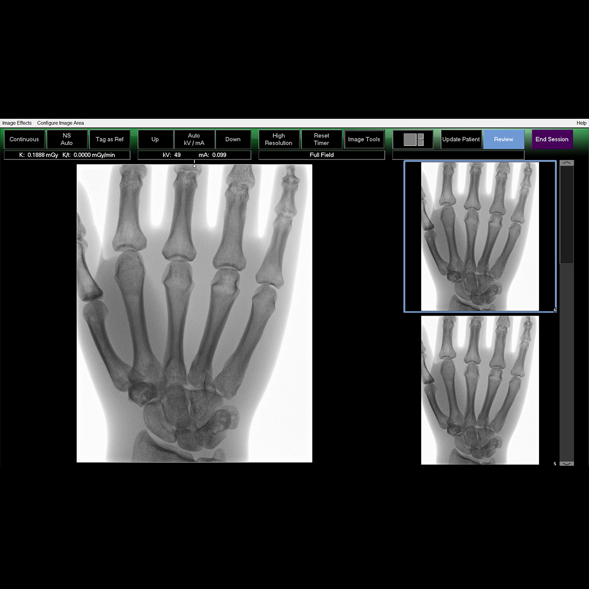 Fluoroscan® InSight® Mini C-arm Extremities Imaging System | Hologic