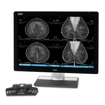 Selenia® Dimensions® Mammography System | Hologic
