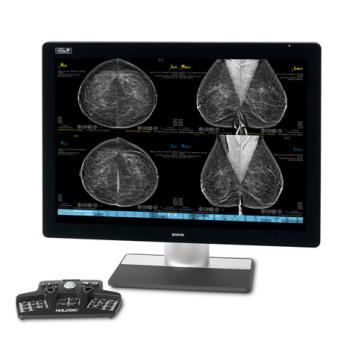 SecurXchange® Workflow Solutions | Hologic